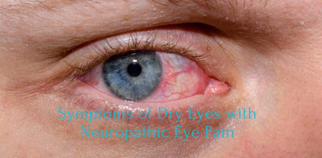 Treatment for dry eye symptoms with presumed neuropathic ocular pain